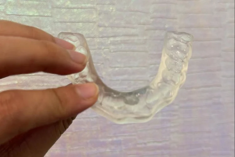 Reliable and Caring Dental Clinic for Custom Mouth Guards: Prevent ...